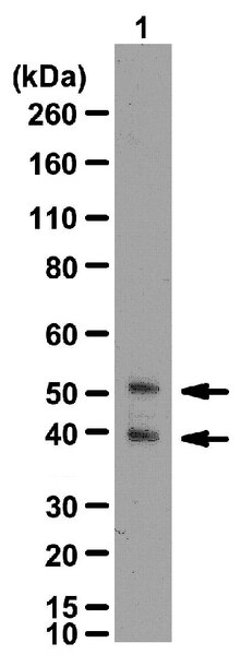 Anti-PBX1 Antibody | 06-1330